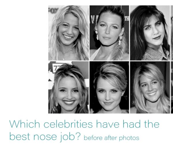 Which Celebrities have had the Best Nose Job? Before-After Photos ...