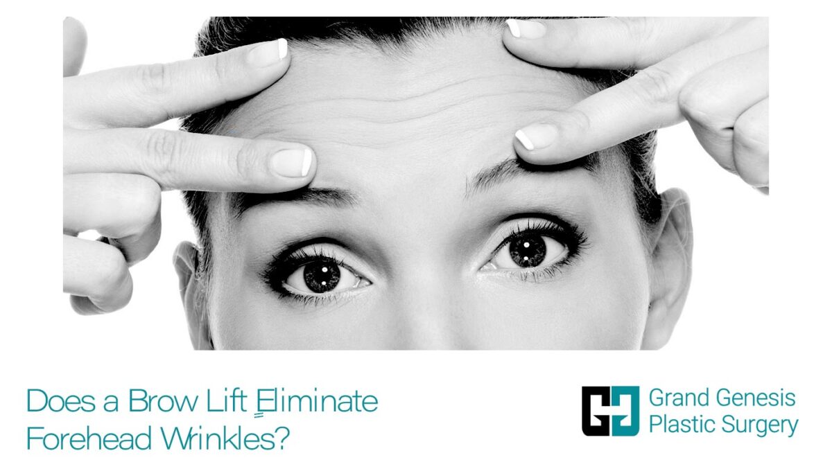 Brow Lift (Forehead Lift) - GRAND GENESIS PLASTIC SURGERY