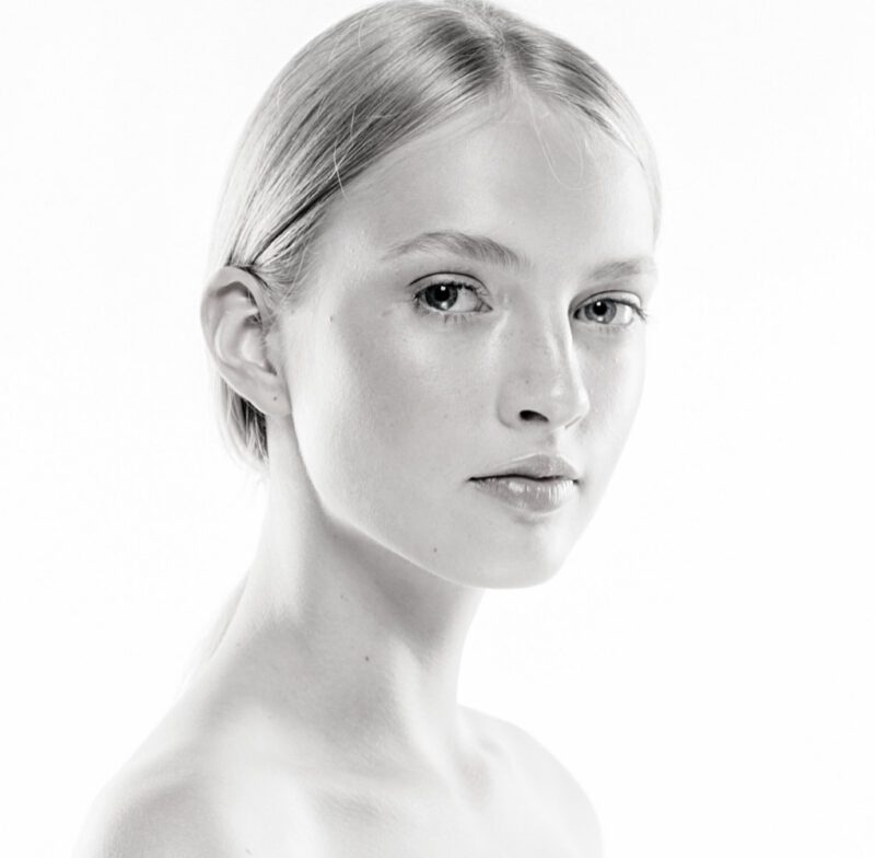 Eye Cheek Bag Removal in Richmond Hill - GRAND GENESIS PLASTIC SURGERY